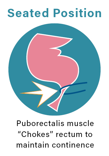 How to Sit on The Toilet to Relieve Constipation - PTandMe