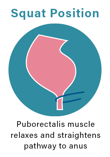 How to Sit on The Toilet to Relieve Constipation - PTandMe