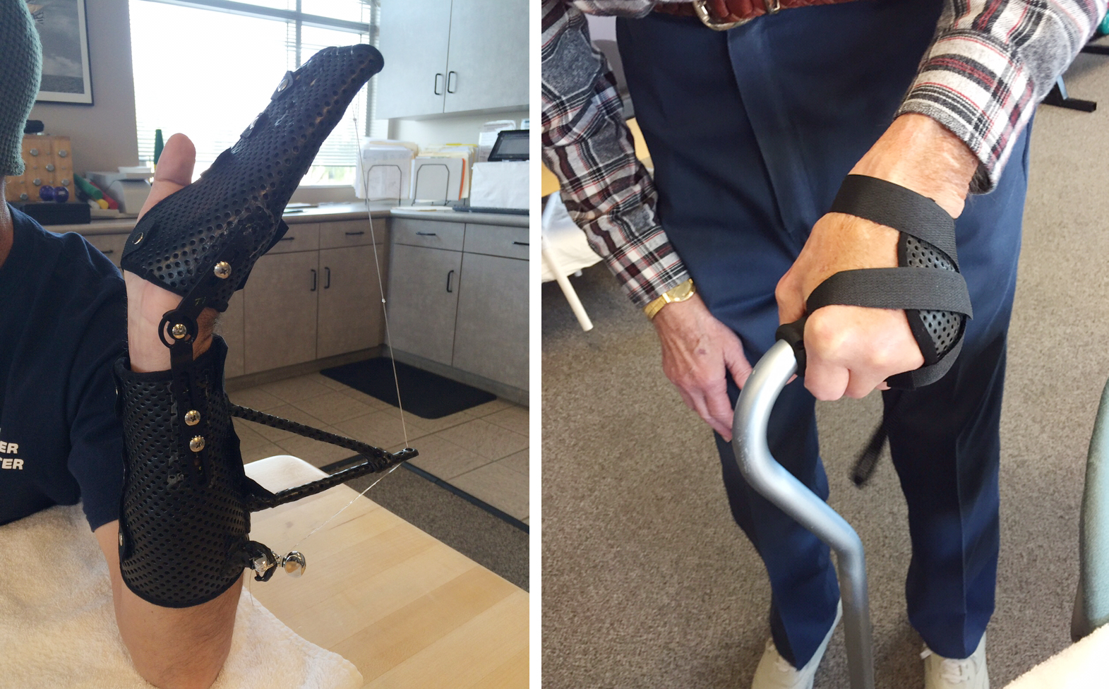 Benefits of Custom-Made Splints for Hand and Wrist Injuries - PTandMe